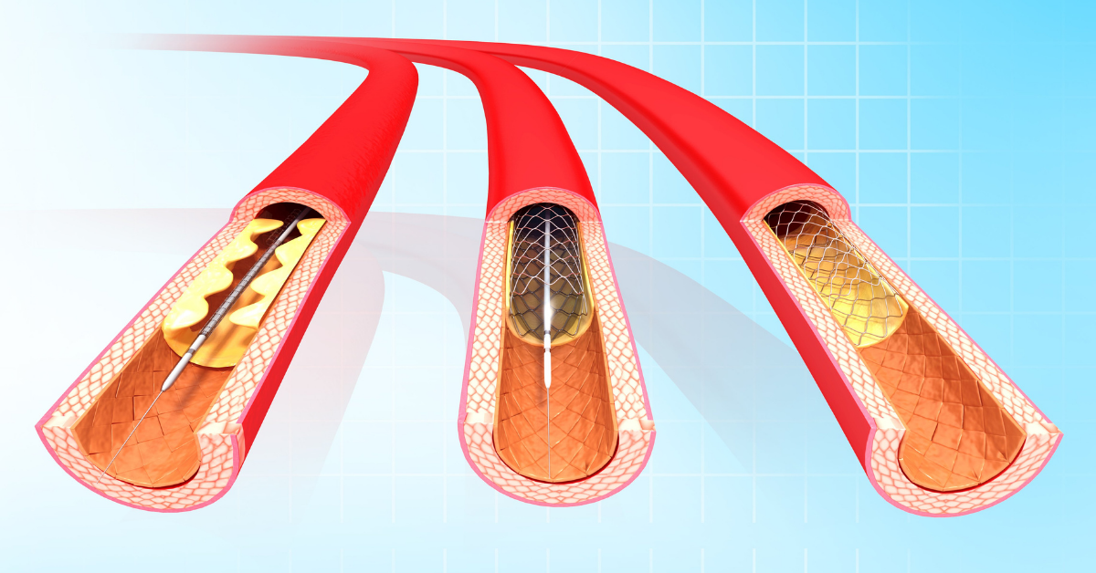 Vertigo | Manhattan Cardiology | Manhattan, NY