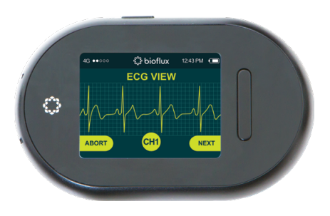 ECG Monitoring - Manhattan Cardiology