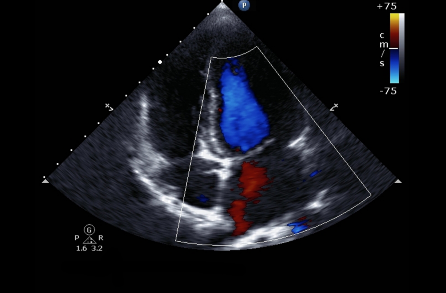 Echocardiogram | Manhattan Cardiology | Manhattan, NY