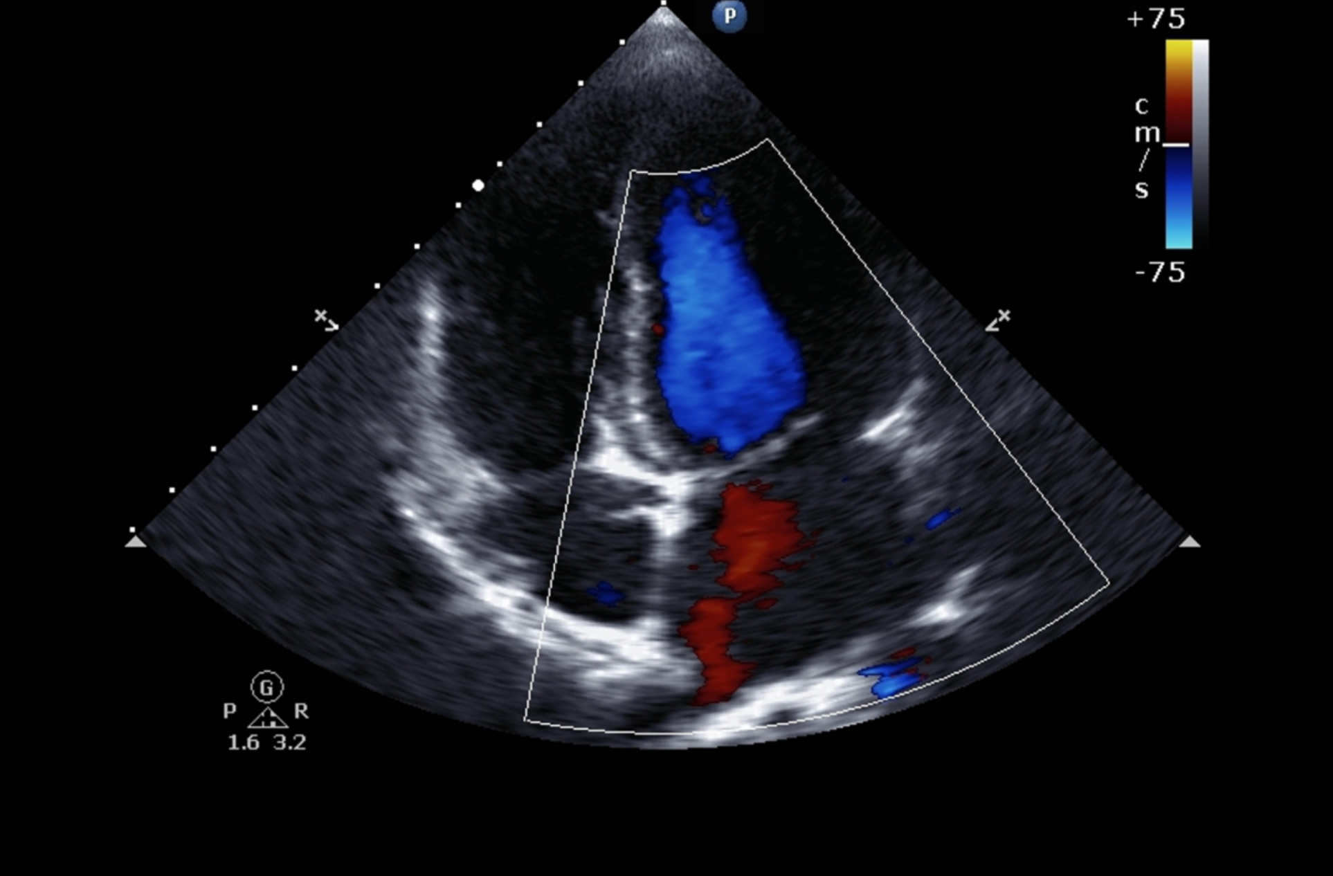 Echocardiogram | Manhattan Cardiology | Manhattan, NY